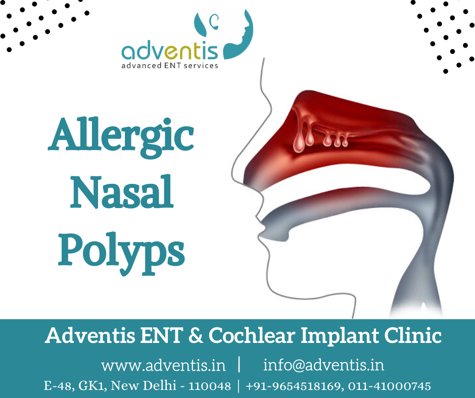 Best Nasal Polyps Treatment, Nasal Polyps Removal & Surgery Cost in ...