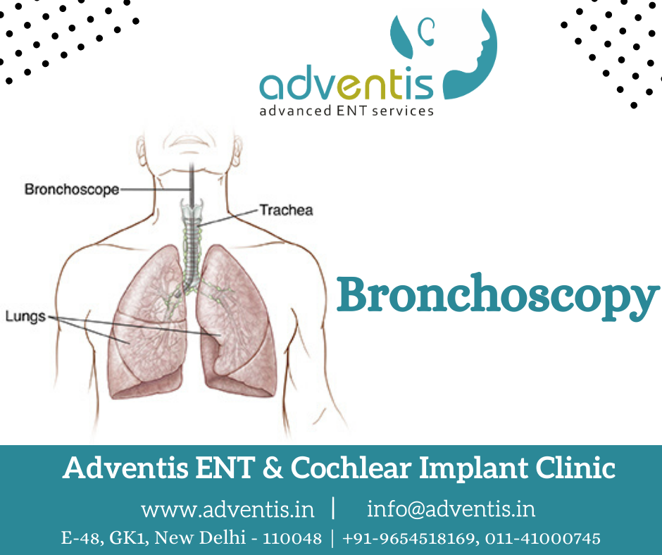 Bronchoscopy Test, Procedure & Treatment in Delhi | Adventis