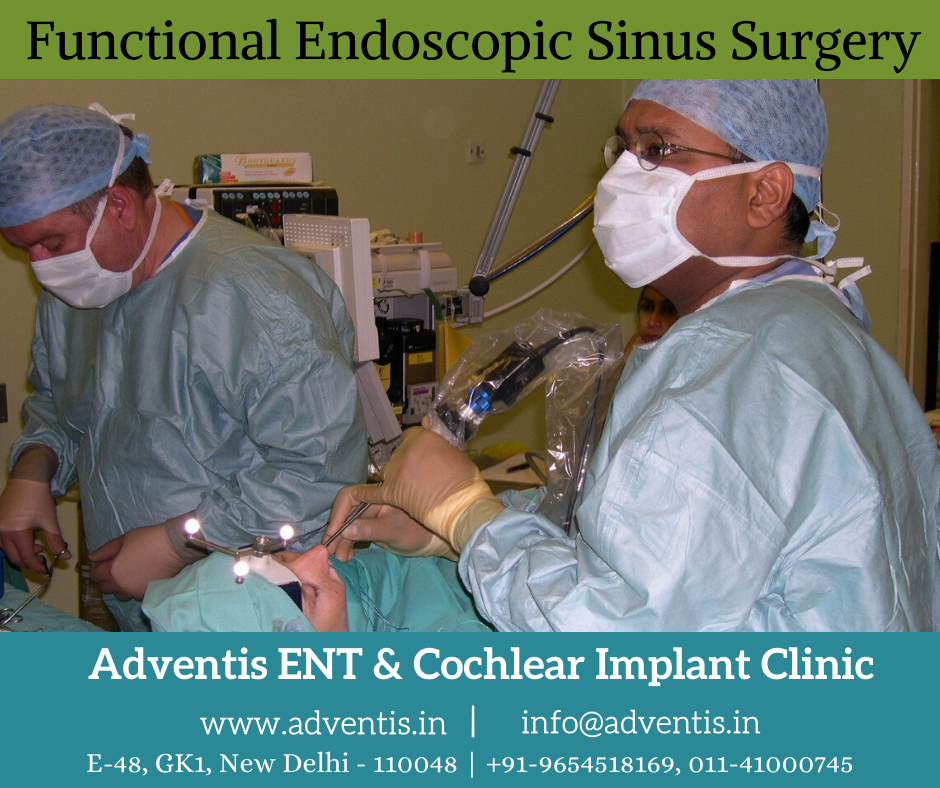 Functional Endoscopic Sinus Surgery in Delhi | Adventis