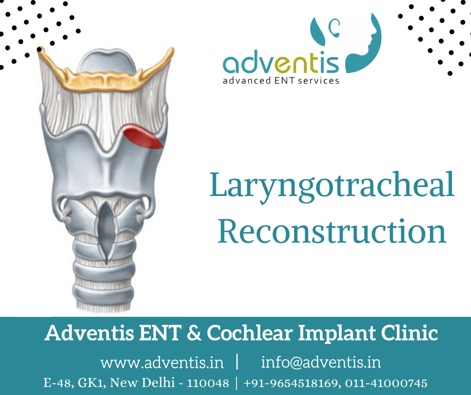 Laryngotracheal Reconstruction - Improve Childs’s Breathing | Adventis