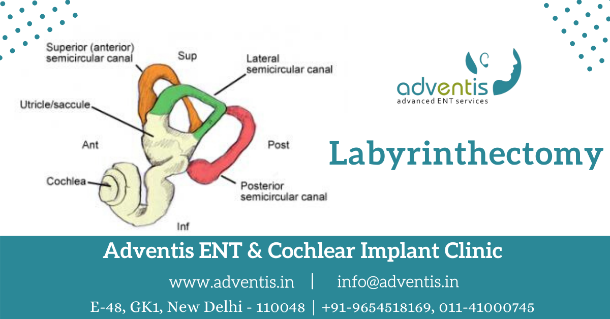 Top Labyrinthectomy Treatment In Delhi Doctor Cost Adventis