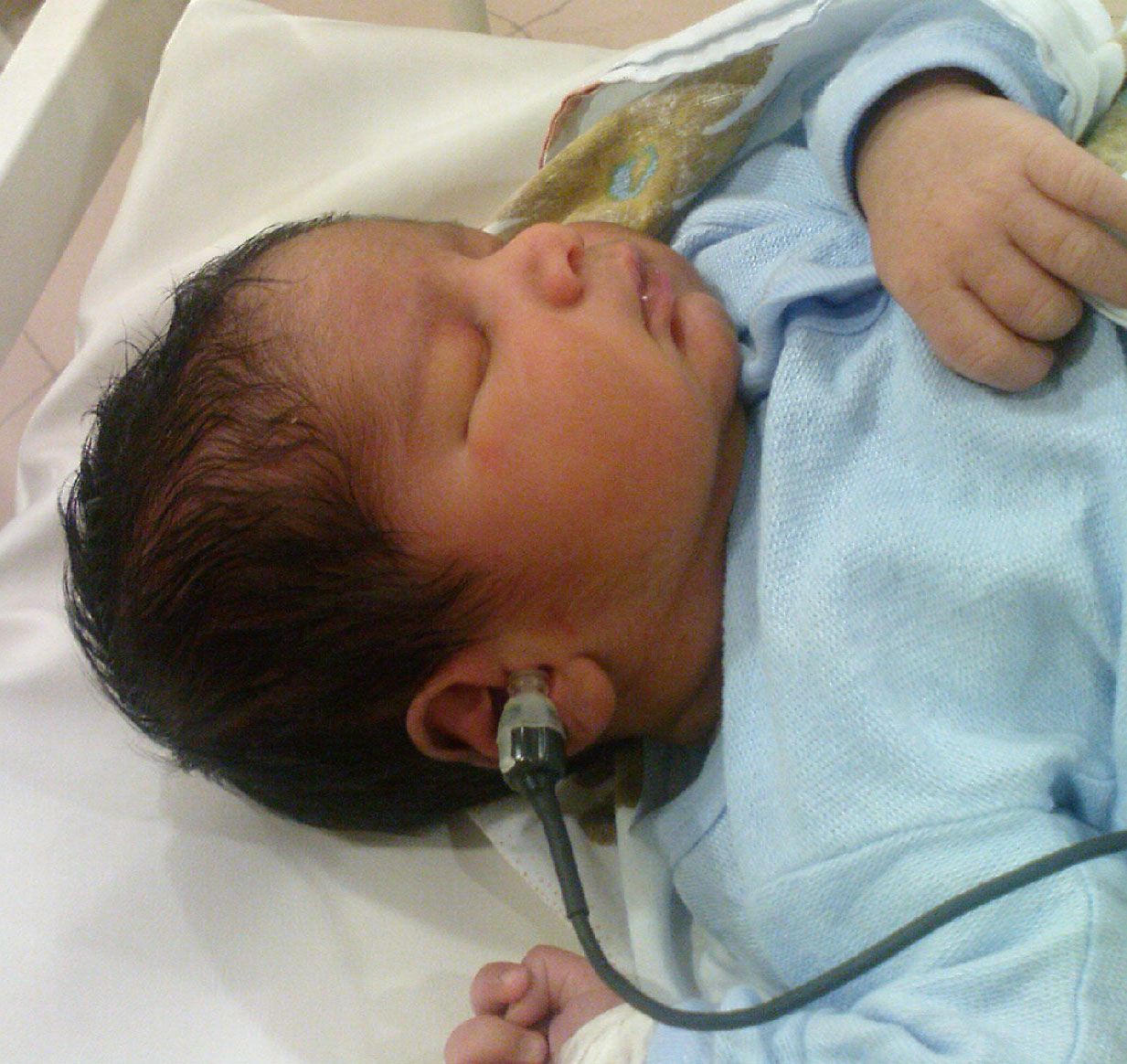 Deafness Treatment - Pediatric Ear Profound Deafness Surgery | Adventis