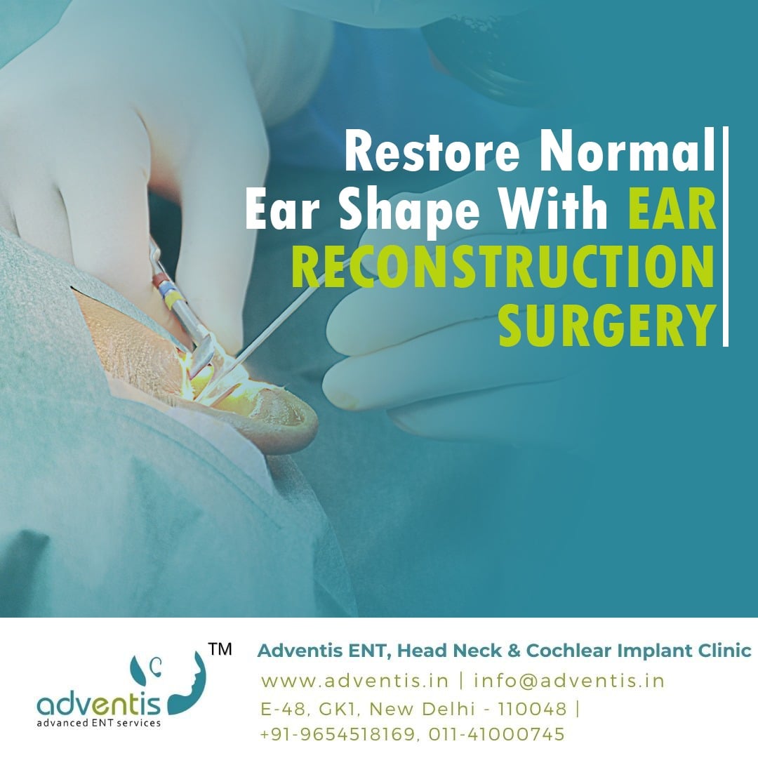 Ear Reconstruction Surgery, Microtia Best Surgeon in Delhi, India ...