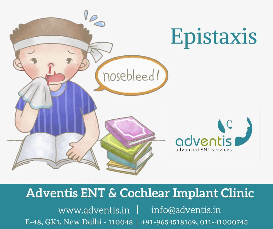 Nasal Bleeding Treatment, Epistaxis Treatment in Delhi | Adventis