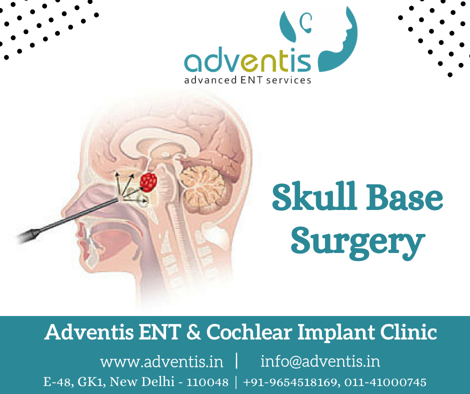 Skull Base Surgery & Treatment in Delhi - Top Skull Base Surgeons ...