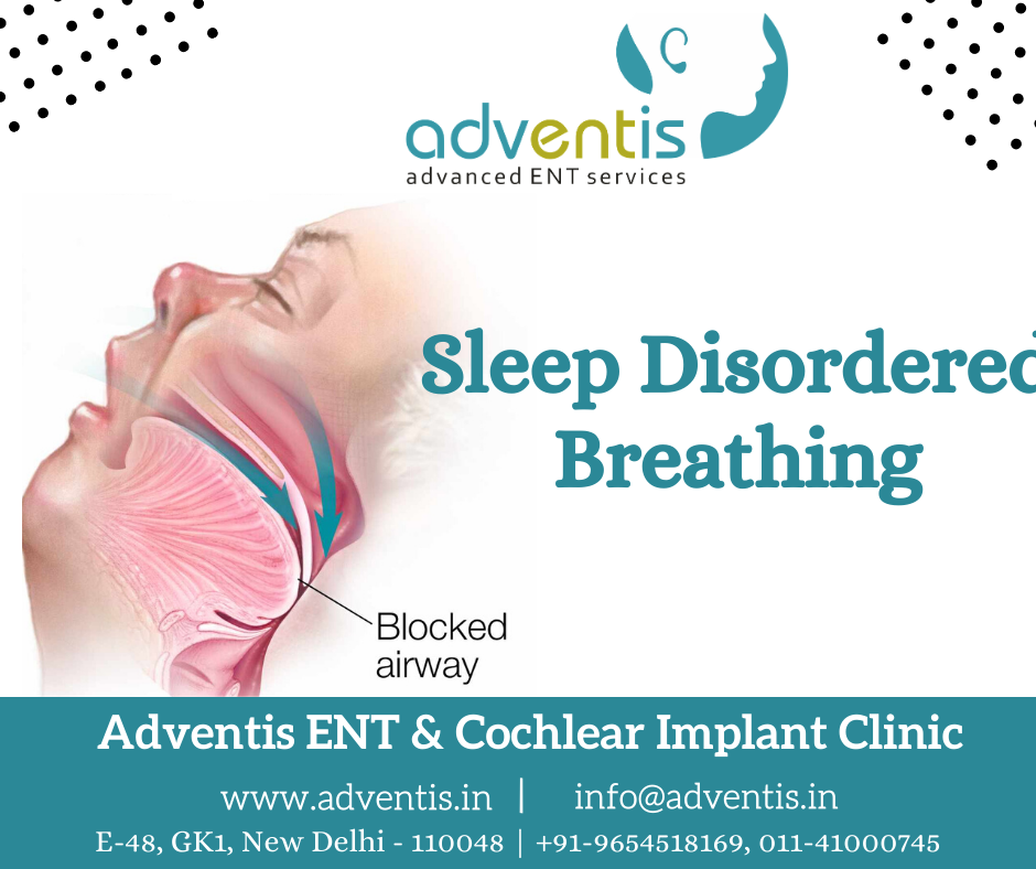 Sleep Disorder Breathing Treatment in Delhi | Adventis