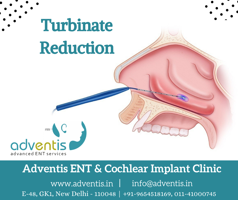 Turbinate Reduction, Nasal Turbinate Reduction Treatment & Surgery ...